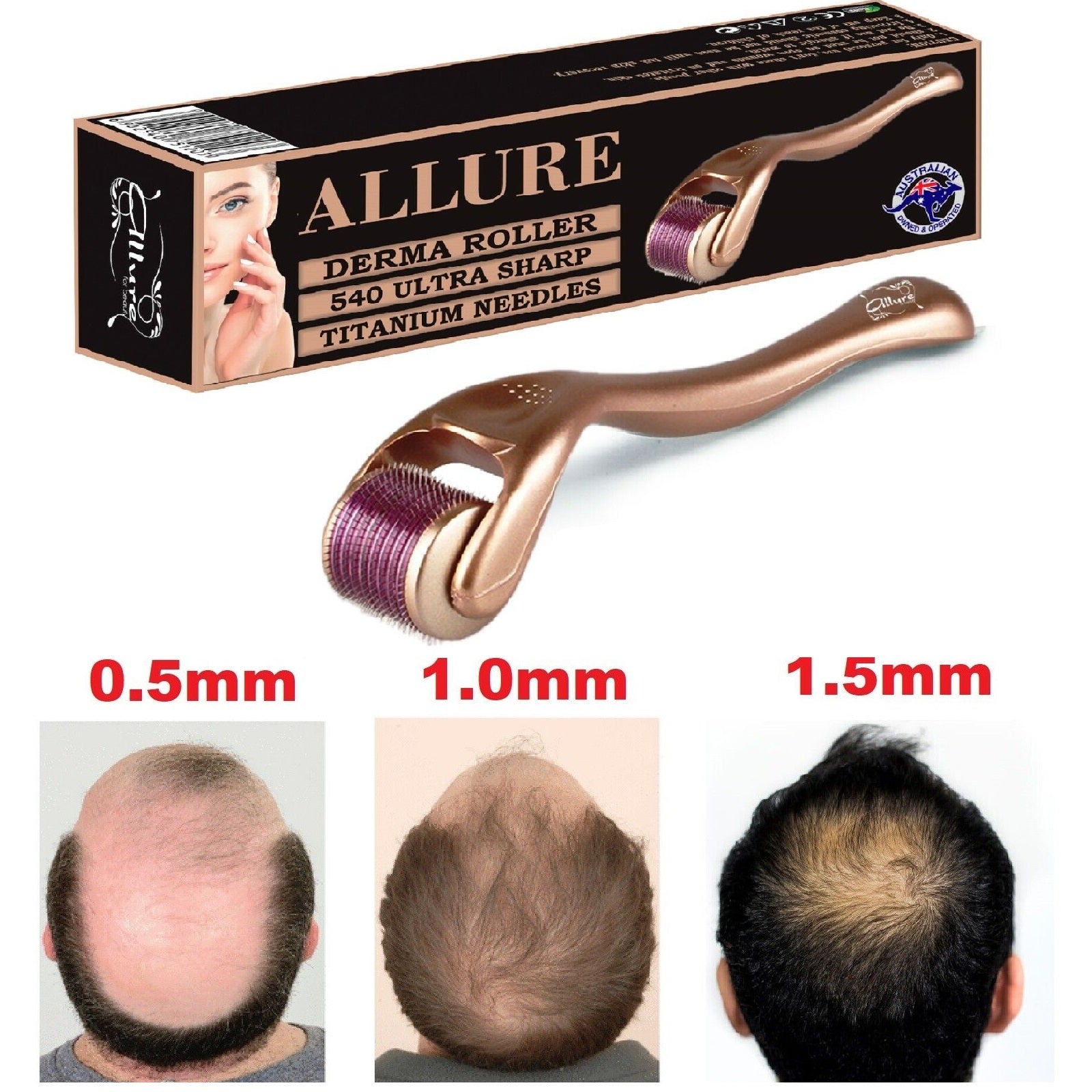 Derma Roller Hair Loss Regrowth 540 Real Titanium Needles Baldness ...